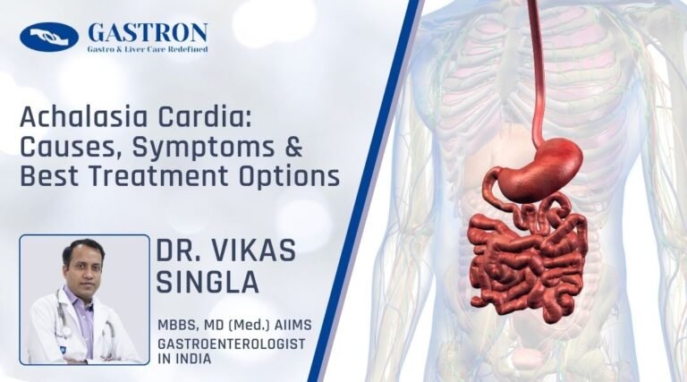 Achalasia Cardia: Causes, Symptoms & Best Treatment Options
