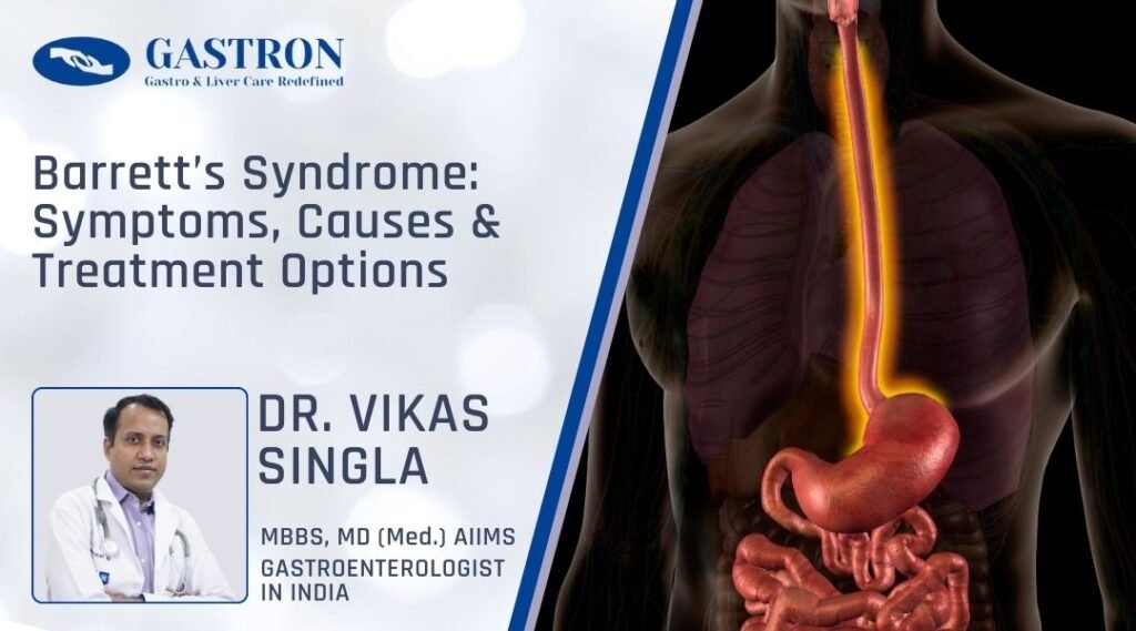 Barrett Syndrome: Symptoms, Causes & Treatment Options