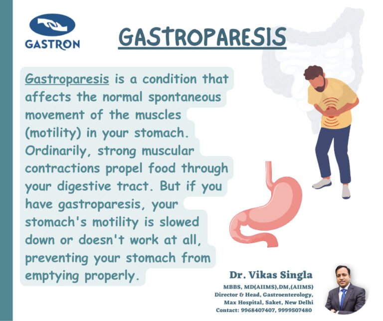 About Gastroparesis by Dr.Vikas Singla | Gasteroentrologist