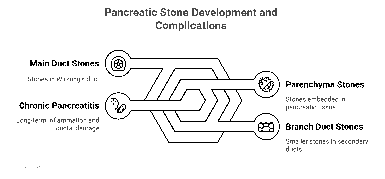 Pancreatic Stones: Symptoms, Causes & Best Treatment options