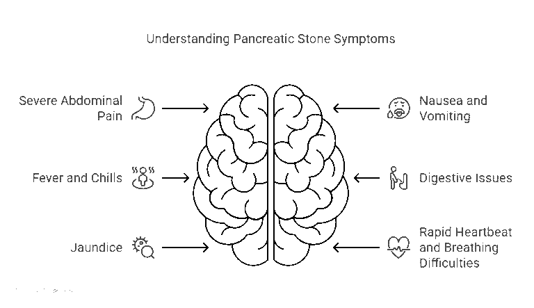 Pancreatic Stones: Symptoms, Causes & Best Treatment options