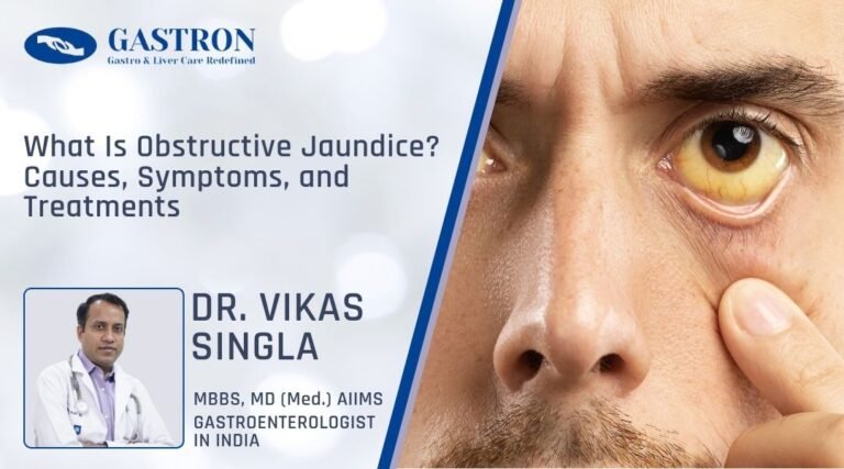 What Is Obstructive Jaundice? Causes, Symptoms, and Treatments