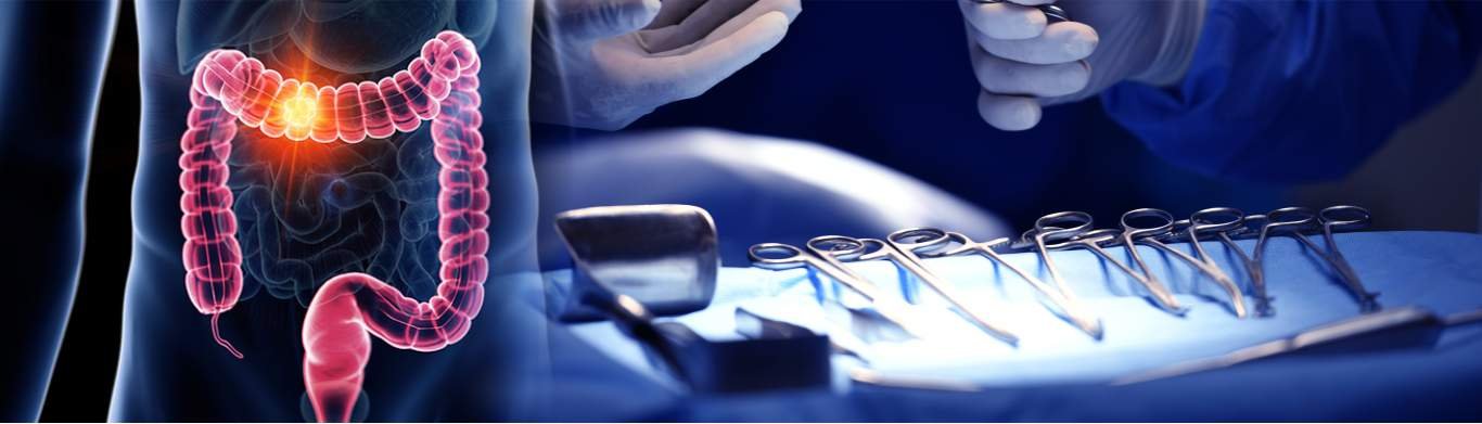 Explore Precision Diagnosis with Double Balloon Enteroscopy & Capsule ...